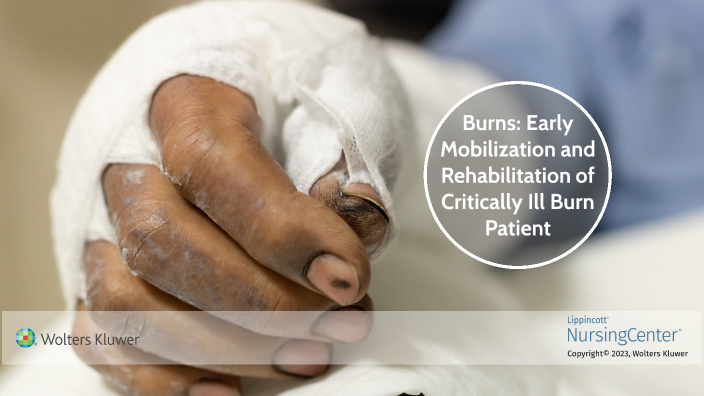 Early Mobilization and Rehab of Burn Patients by Myrna Schnur on Prezi