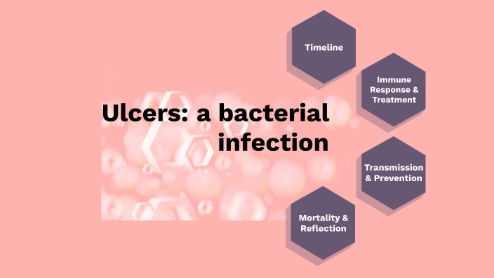 Pathogen Project: Ulcers by Lillian Cook on Prezi