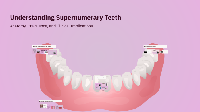 Understanding Supernumerary Teeth by Yulissa Ponce Acosta on Prezi