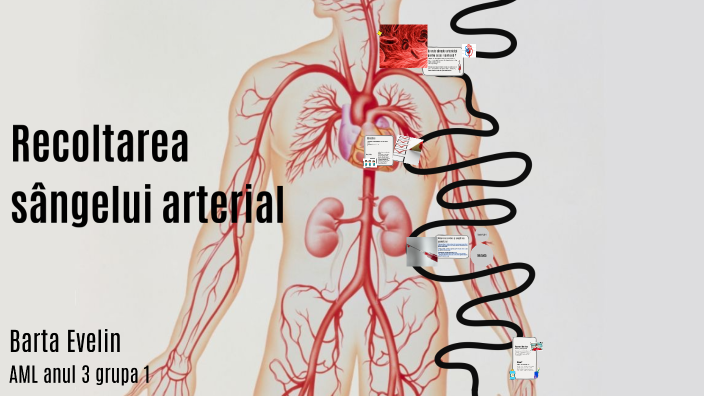 Prelevarea sângelui arterial by Evelin Barta on Prezi