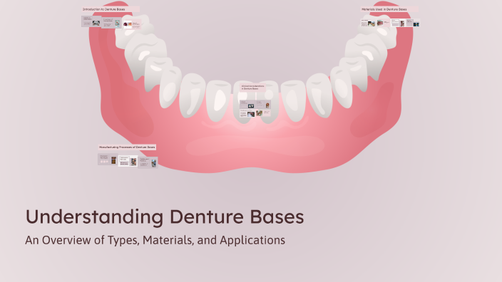 Understanding Denture Bases by MISK NADAF on Prezi