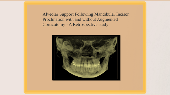 alveolar support following Mandibular incisor proclination w by tala ...