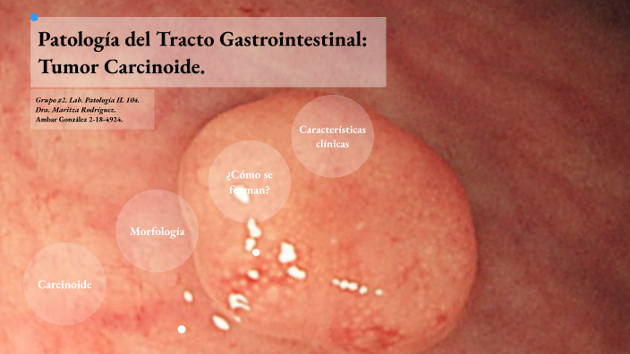 Patologías del Tracto Gastrointestinal: Tumor Carcinoide. by Ambar ...