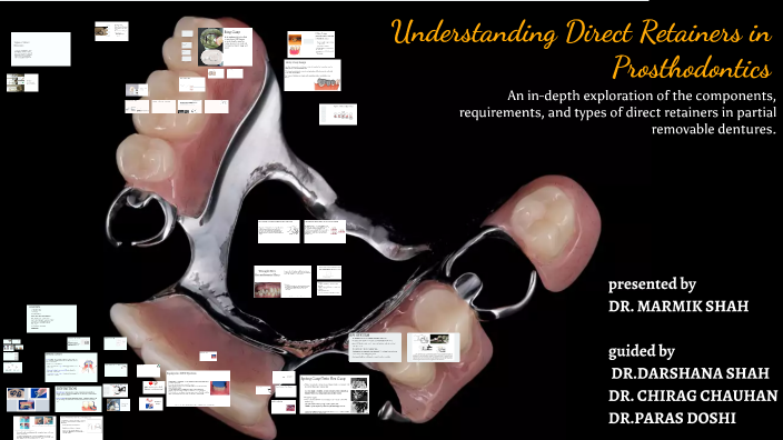 Understanding Direct Retainers in Prosthodontics by Marmik shah on Prezi
