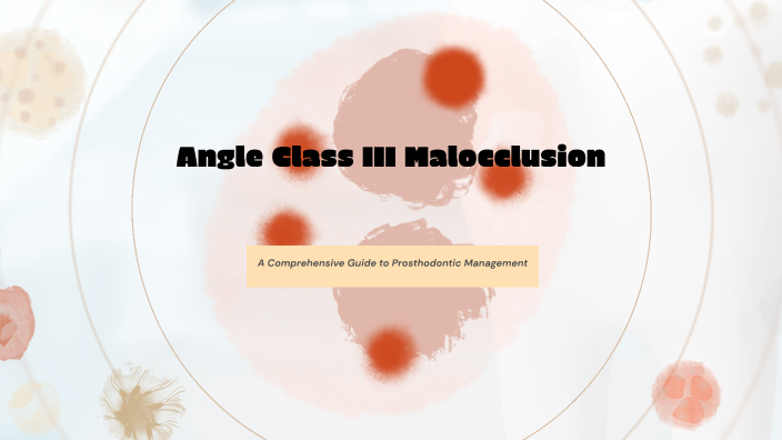 Angle Class III Malocclusion by anngella orraiz on Prezi