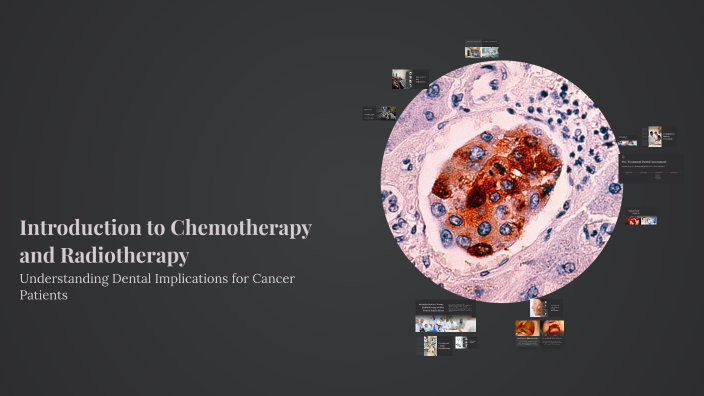Introduction to Chemotherapy and Radiotherapy by Natalie on Prezi