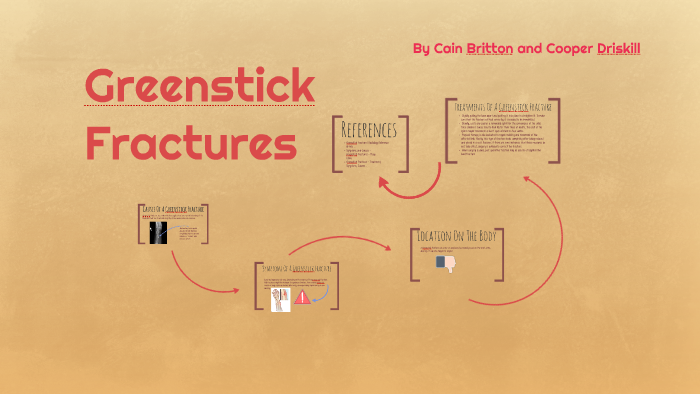 Greenstick Fracture by Cooper Driskill on Prezi