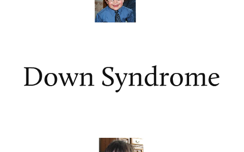 Down Syndrome by Brandon Underhill on Prezi