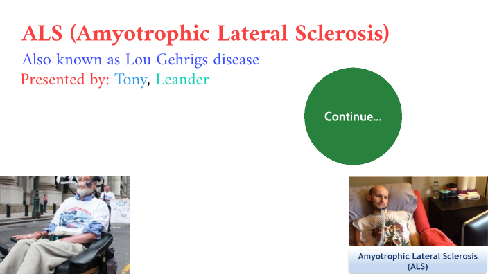 ALS/ Lou Gehrig's disease by Leander Mcdaniel Gonzalez on Prezi