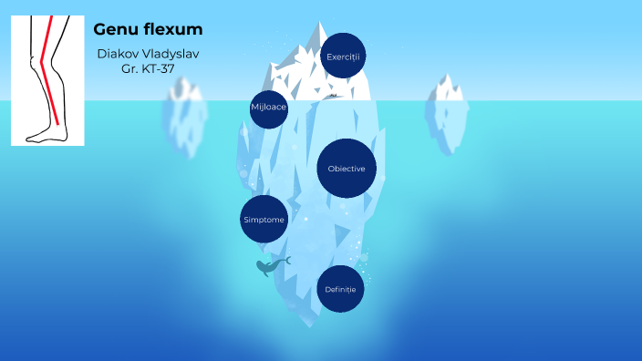 Genu flexum by Vladyslav Diakov on Prezi