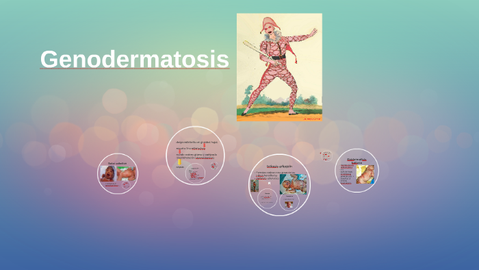 Genodermatosis by Isma Sa Pa on Prezi