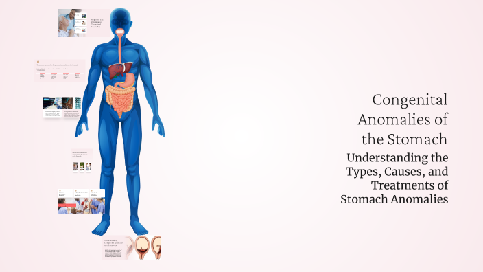 Congenital Anomalies of the Stomach by Varsha Bhat on Prezi