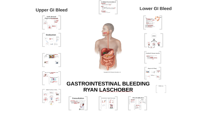 GASTROINTESTINAL BLEEDING by on Prezi