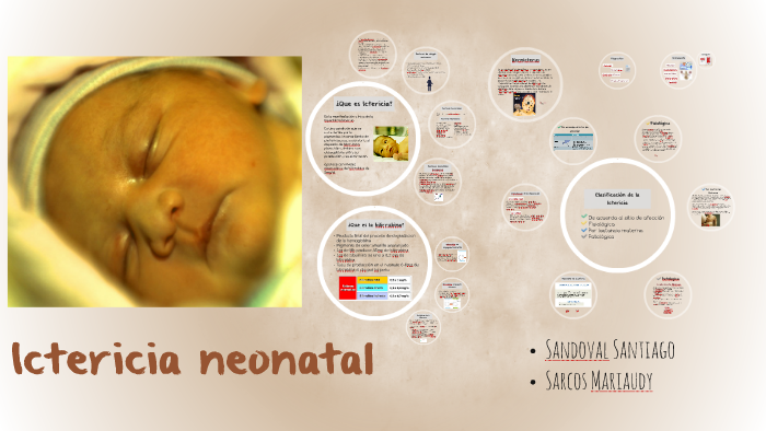 Ictericia neonatal Def by Mariaudy Sarcos on Prezi