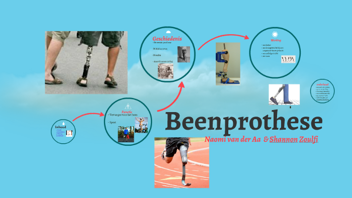 Beenprothese by shannon Zoulfi