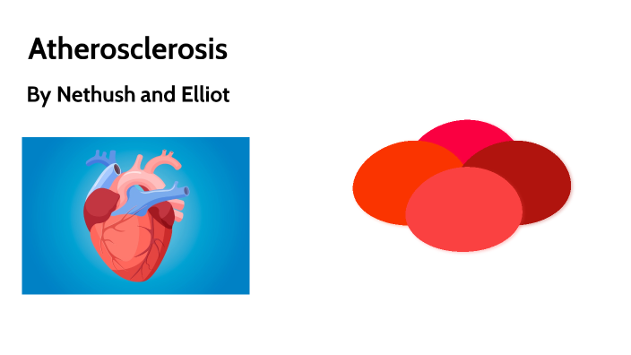 Atherosclerosis by Nethush Vithanage on Prezi