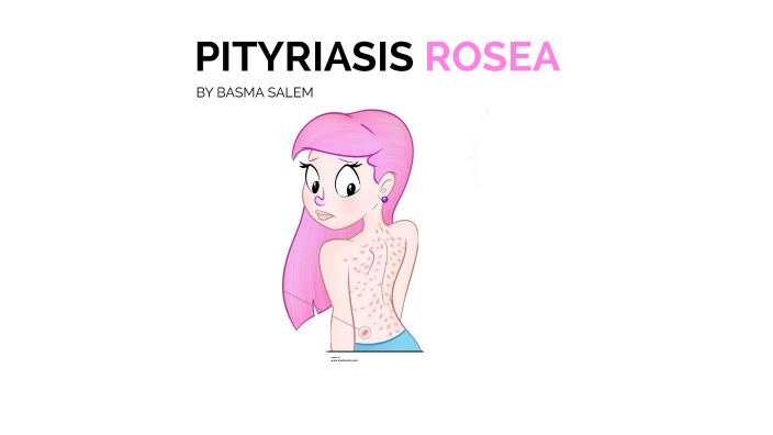 pityriasis rosea by basma Salem on Prezi
