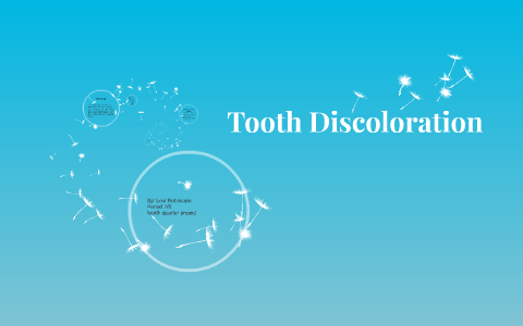 Tooth Discoloration by lexi rubincam on Prezi