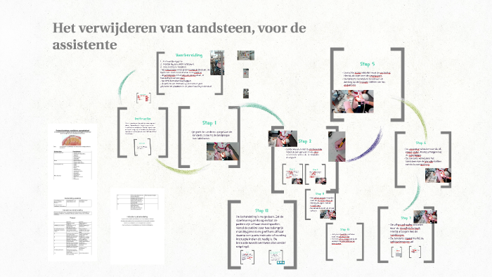 Het verwijderen van tandsteen by Marit van de Ven Het verwijderen van tandsteen by Marit van de Ven