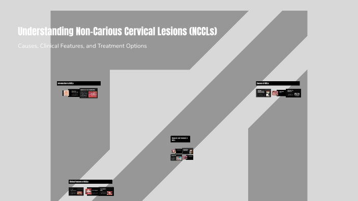 Understanding Non-Carious Cervical Lesions (NCCLs) by einas abu hjoul on Prezi