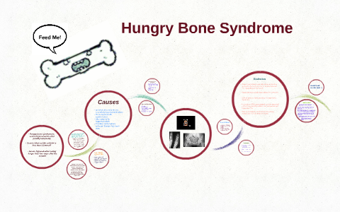 Hungry Bone Sydrome by Hana Shalabi on Prezi