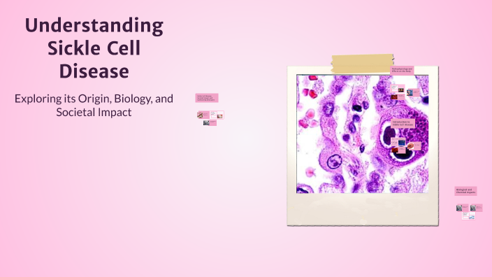 Sickle Cell Project 2 by Kyle Vannieuwenhoven on Prezi