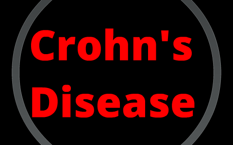 Crohn's Disease by Aaron Pennell on Prezi
