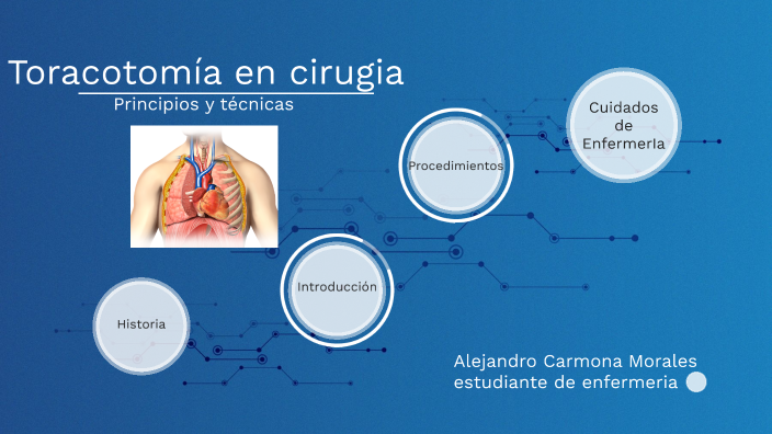 Toracotomía by Alejandro Carmona Morales on Prezi