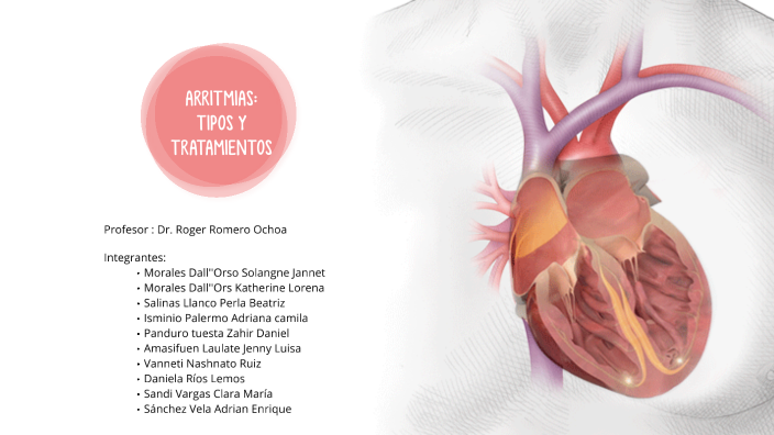 Arritmias (Tipos y tratamientos) by S M on Prezi