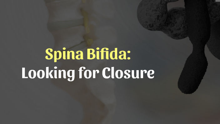 Spina Bifida : Looking for Closure by ELLESSE HOLDEN on Prezi