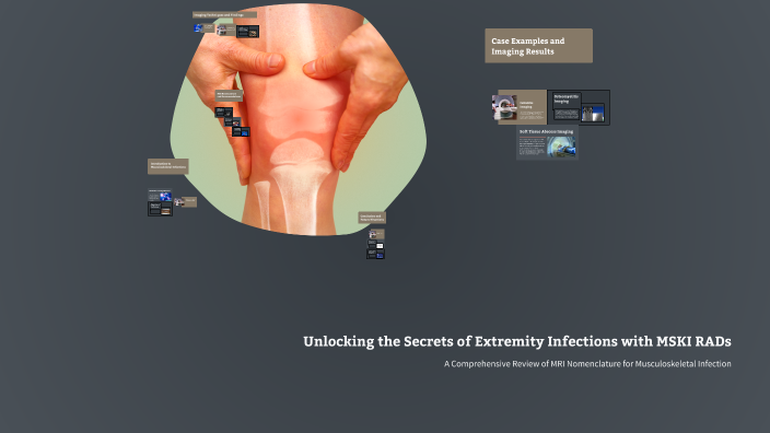 Unlocking the Secrets of Extremity Infections with MSKI RADs by Amro ...