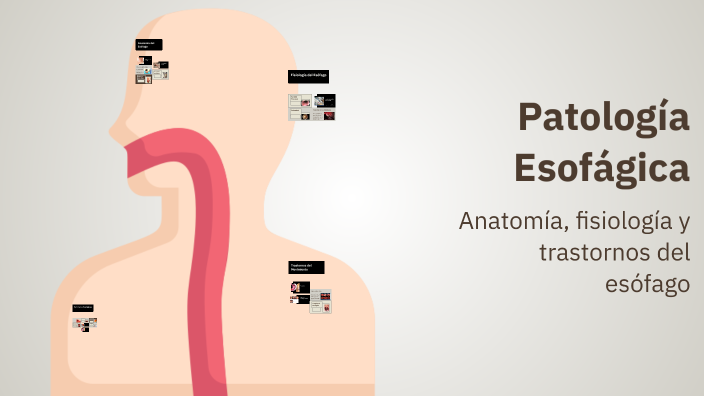 Patología Esofágica by Ana Pao Nava on Prezi