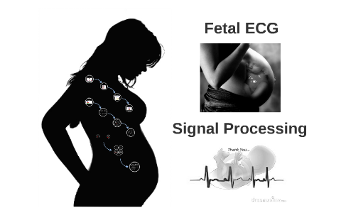 Fetal ECG Signal Processing by Andres Erazo on Prezi