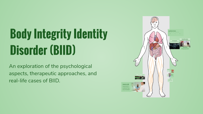 Body Integrity Identity Disorder (BIID) by Aayla Webb on Prezi