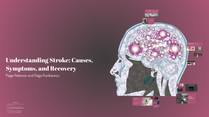 Understanding Stroke: Causes, Symptoms, and Recovery by paige stull on ...