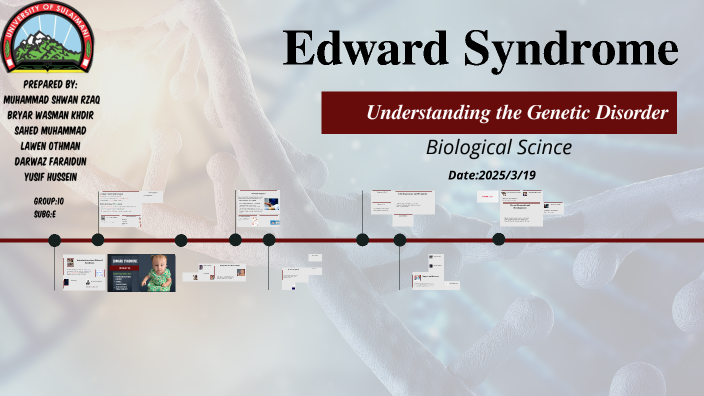 Edward Syndrome by Hama Shwan on Prezi
