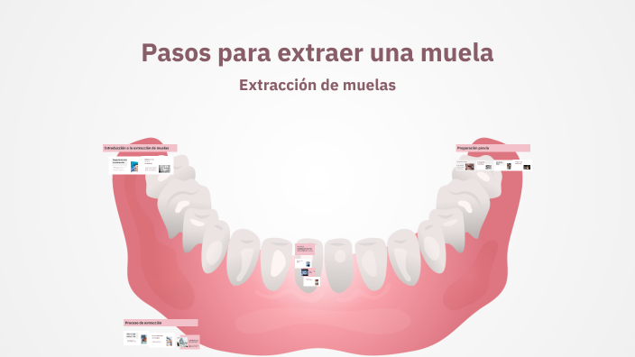 Pasos para extraer una muela by Daniel Hernández Michel on Prezi