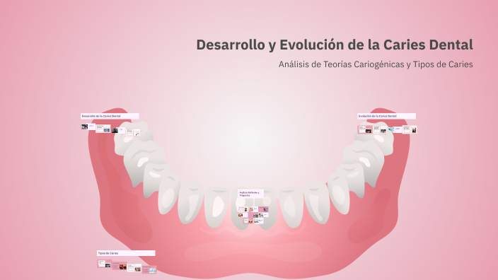 Desarrollo y Evolución de la Caries Dental by natty massiel baez mota ...