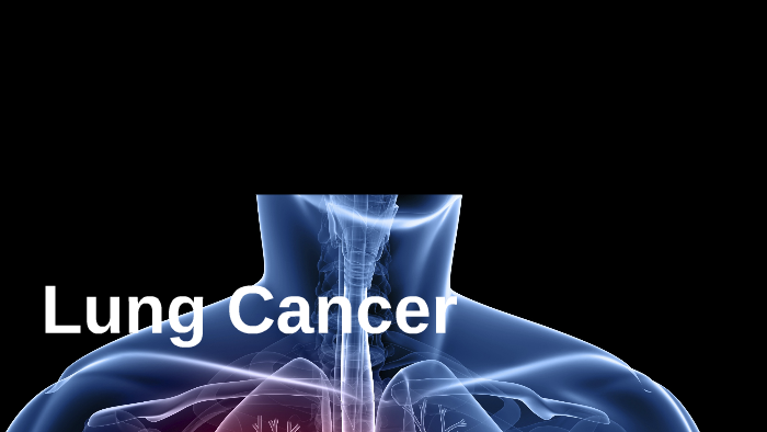 Lung Cancer by Sadaf Popal on Prezi