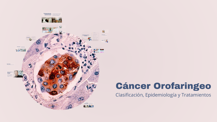 Cáncer Orofaringeo by Daniel Nauras Obied Martínez on Prezi