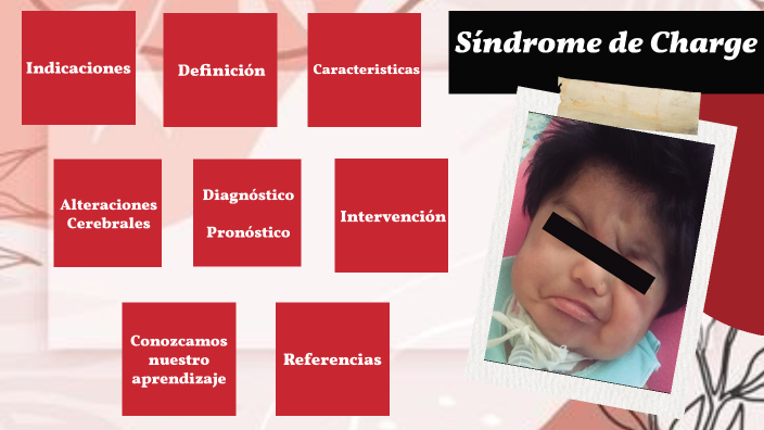 Síndrome de Charge by Karito Burgos on Prezi