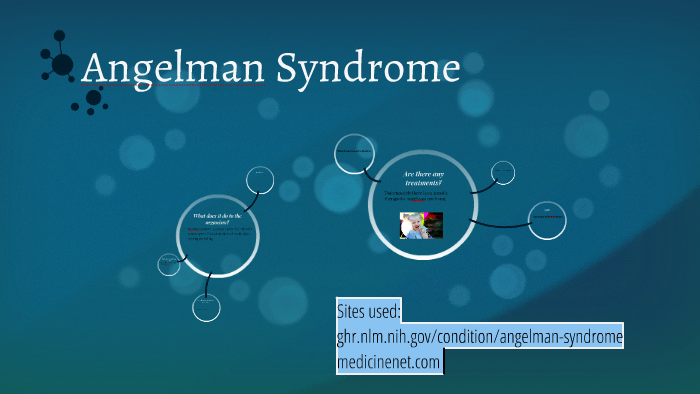 Angelman Syndrome by abigail maya on Prezi