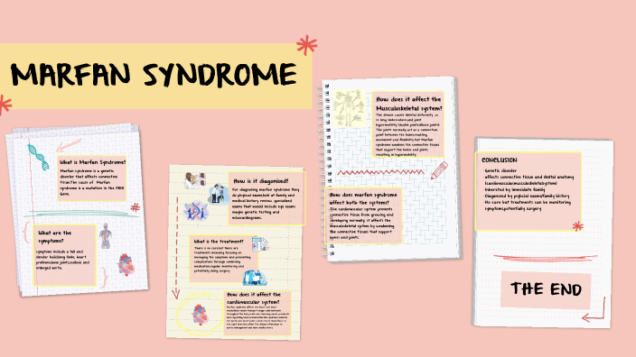MARFAN SYNDROME by Eleanor Georges on Prezi
