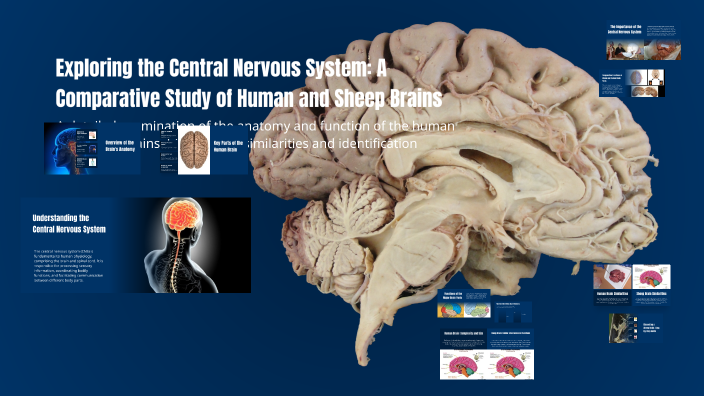 Exploring the Central Nervous System: A Comparative Study of Human and ...