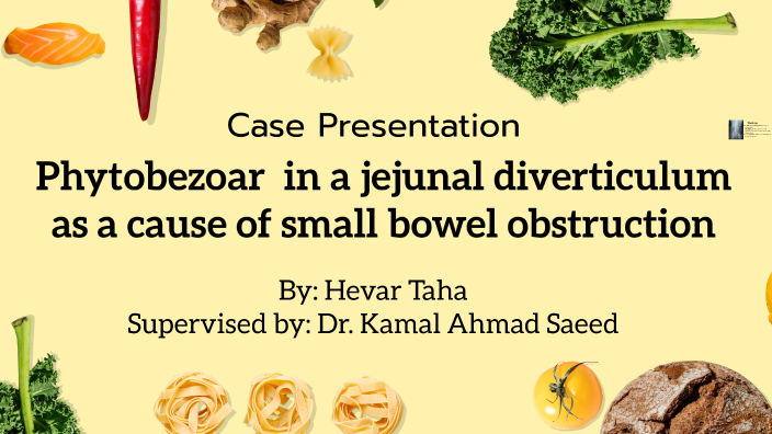Phytobezoar in a jejunal diverticulum as a cause of small bowel ...