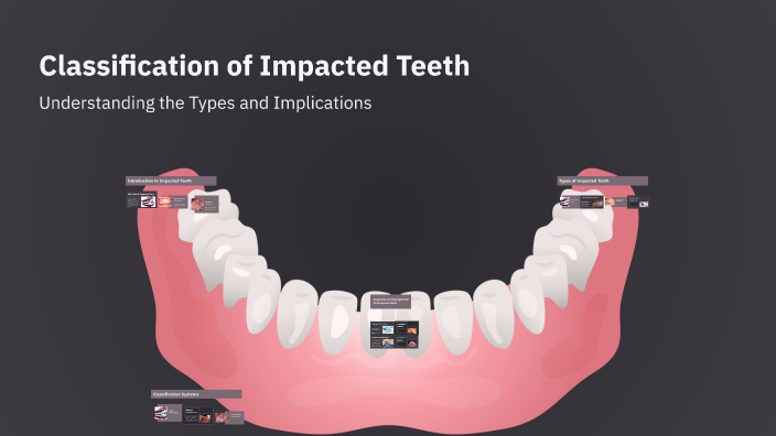 Classification of Impacted Teeth by احمد عبد الفتاح on Prezi