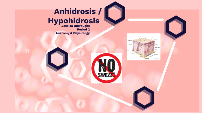 Anhidrosis by Jessica Burroughs on Prezi