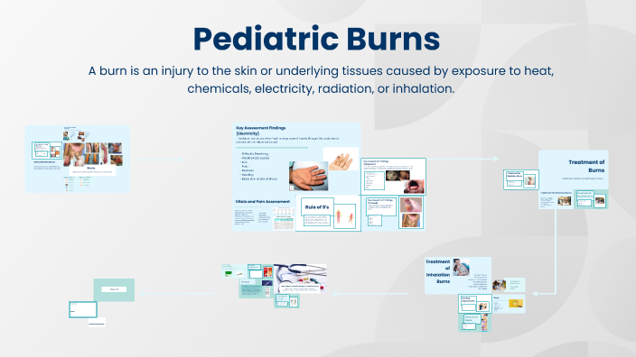 Pediatric Burns: A Comprehensive Overview by katelyn avila on Prezi