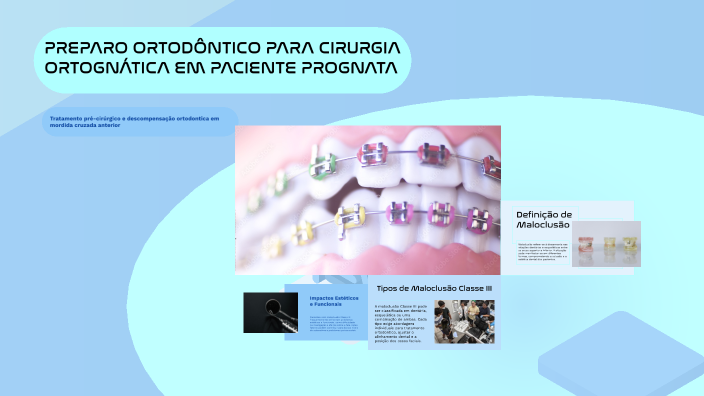 PREPARO ORTODÔNTICO PARA CIRURGIA ORTOGNÁTICA EM PACIENTE PROGNATA by ...