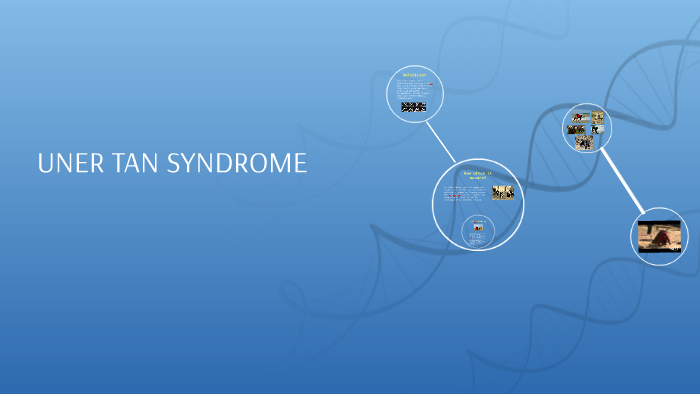 UNER TAN SYNDROME by karen guerra on Prezi